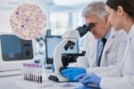 Peripheral Blood Smear Test: Blood Cell Morphology, Abnormal Cells ...